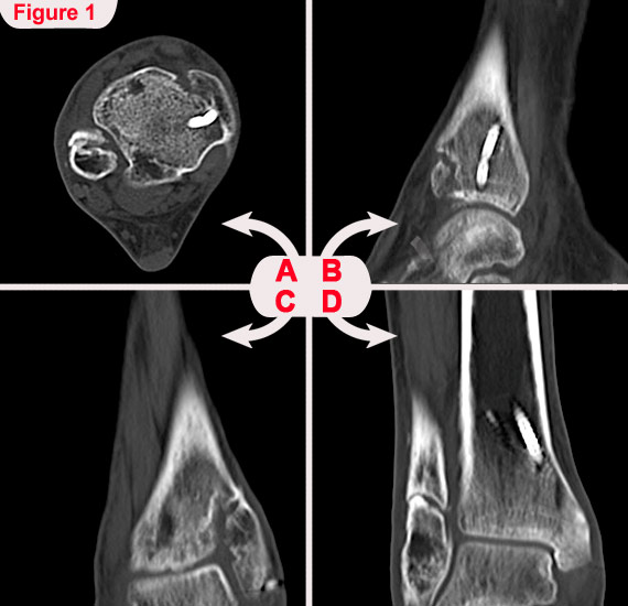 Figure 1 (a-b)