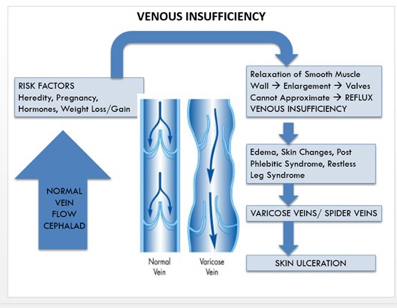 Podiatric Vein Care - Using the Vein Roadmap Analogy to Understand Vein ...