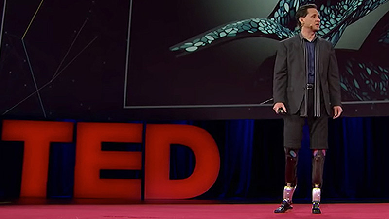 New Bionics Let Us Run, Climb and Dance