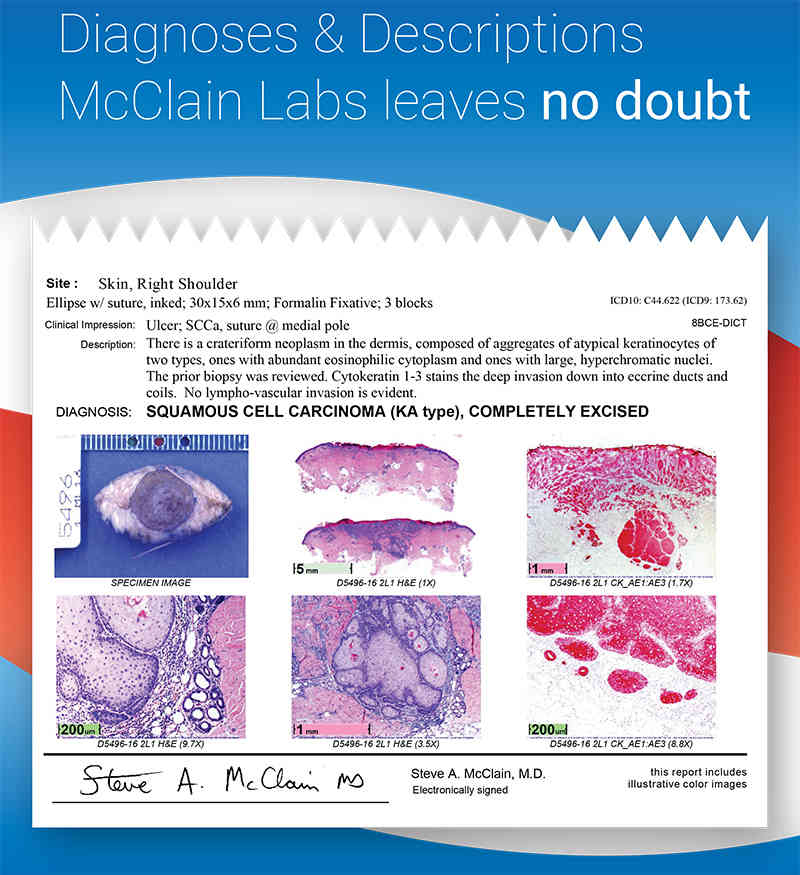 McClain Laboratories - Specializing in Dermatopathology