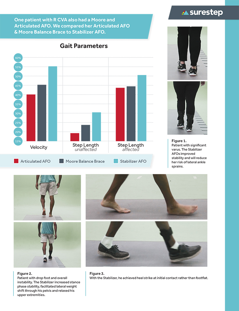 Surestep Stabilizer Study: Preliminary Results