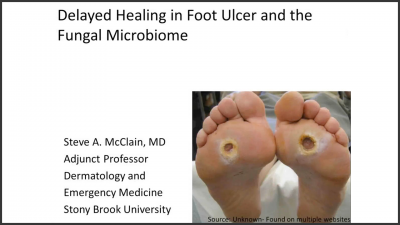 Delayed Healing in Foot Ulcer and the Fungal Microbiome